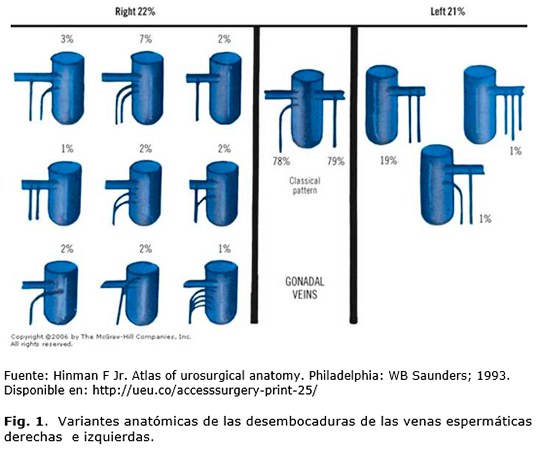 Importancia del varicocele derecho. | Vela Caravia | Revista Cubana de ...