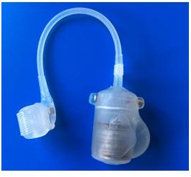 Empleo del esfínter urinario artificial ZSI 375 en la incontinencia ...